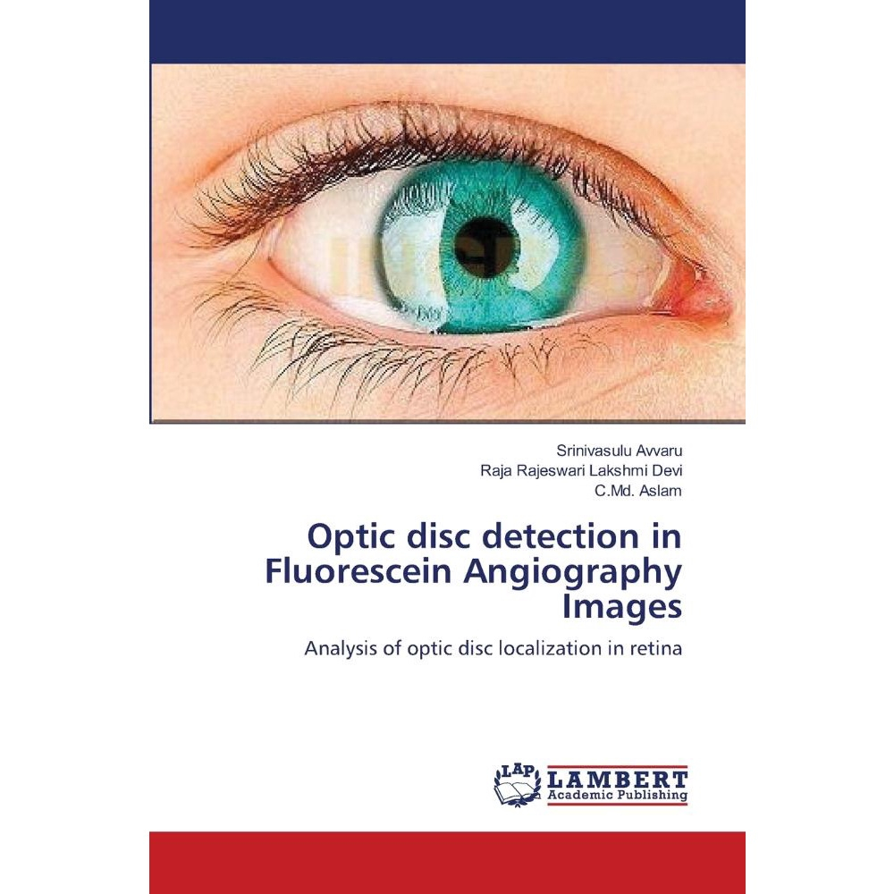 Optic disc detection in Fluorescein Angiography Images | Submarino Optic disc detection in Fluorescein Angiography Images | Submarino